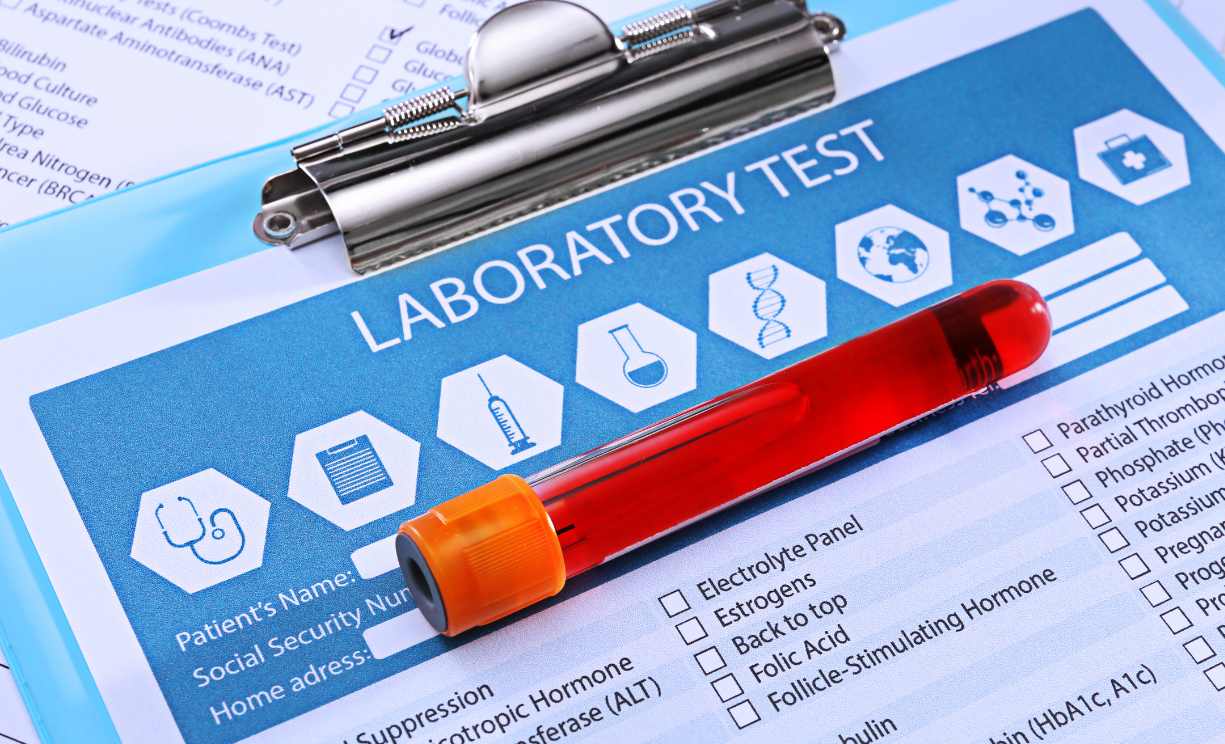 Effective Treatment for Navigating High AMH Levels and PCOS