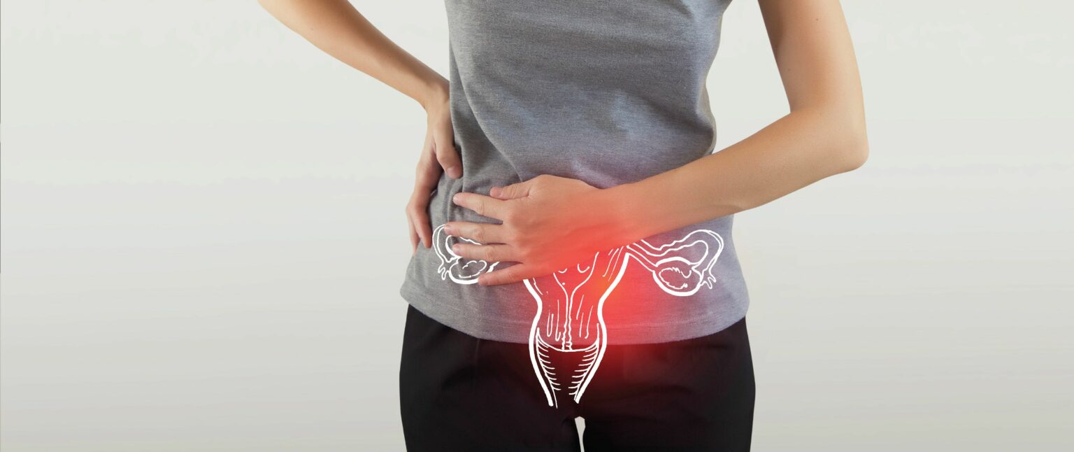 PCOS Amenorrhea Treatment : Types and How Does It Help?