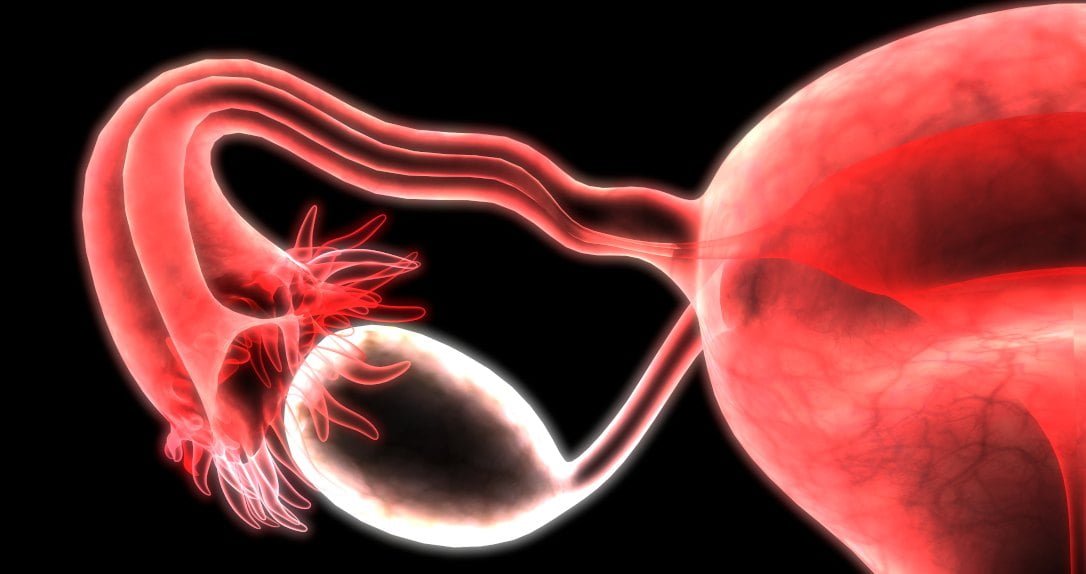 Ovulation Induction In PCOS: Importance & Strategies Used